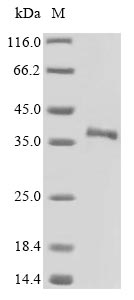 Recombinant Mouse Secreted frizzled-related protein 5 (Sfrp5) – Vareum